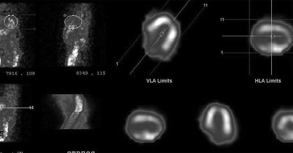 Sinogram - LM Diagnostic